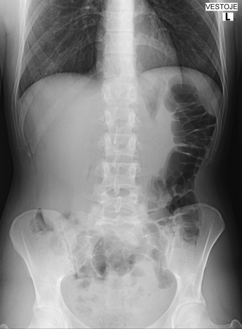Skiagrafická vyšetření - Nemocnice Na Homolce